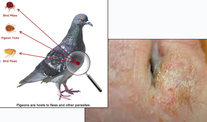 Diseases Carried by Birds - Bird Management